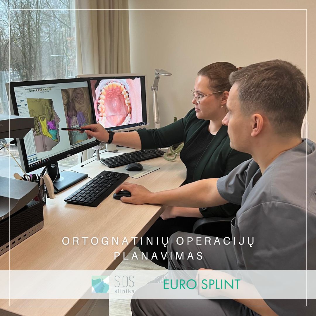 Ortognatinės žandikaulio operacijos planavimas | S'OS klinika